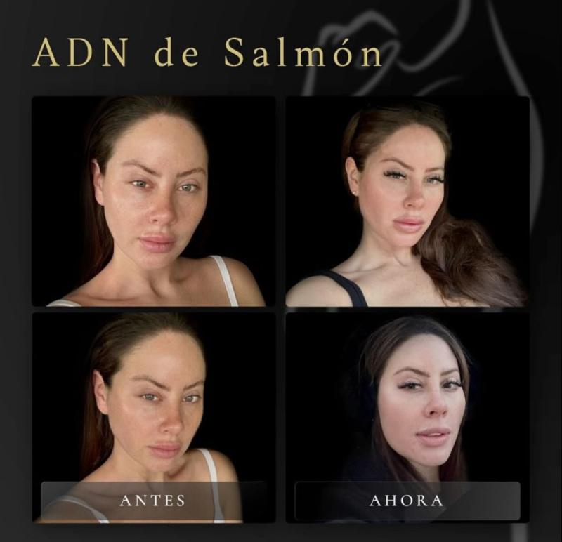 Ignacia Michelson exhibe impactante cambio estético tras innovador tratamiento: “ADN de salmón”