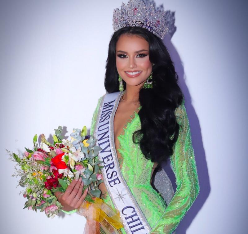 El antes y después de Emilia Dides: la candidata chilena del Miss ...